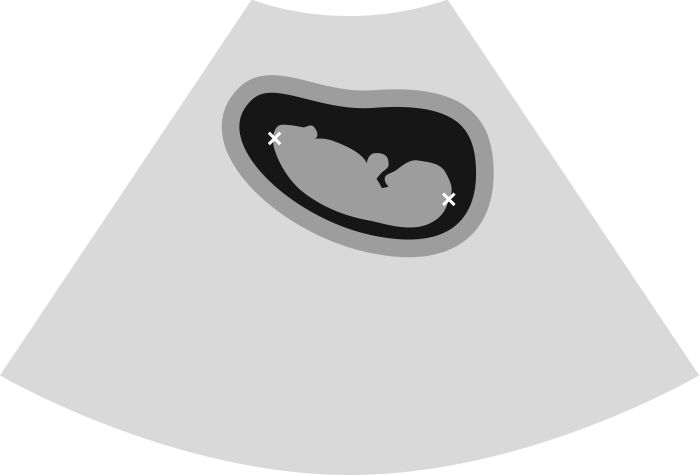Canine Pregnancy Scanning: Module 7 – Animal Ultrasound Association