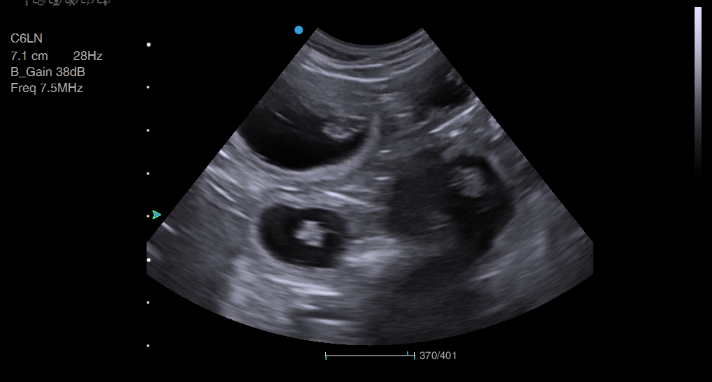 Canine Pregnancy Scan in Bromley - Animal Ultrasound Association