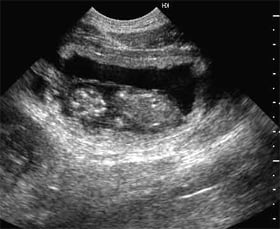 Scanning a pregnant dog – Animal Ultrasound Association