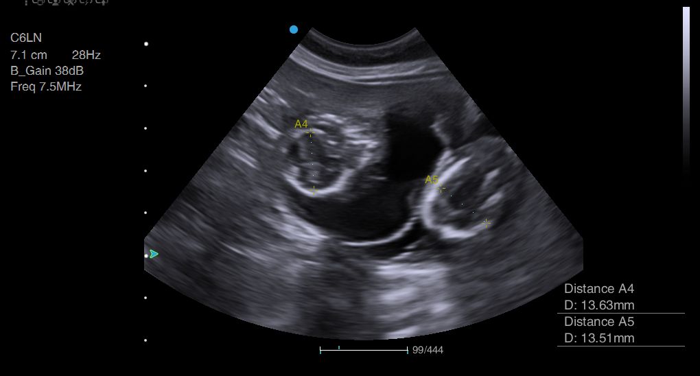 Bella’s Pregnancy Scan – Animal Ultrasound Association
