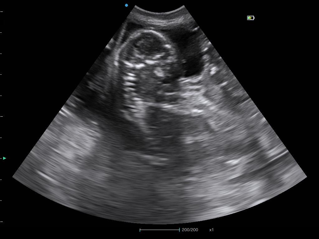 Rescued Cockapoo is PREGNANT! – Animal Ultrasound Association