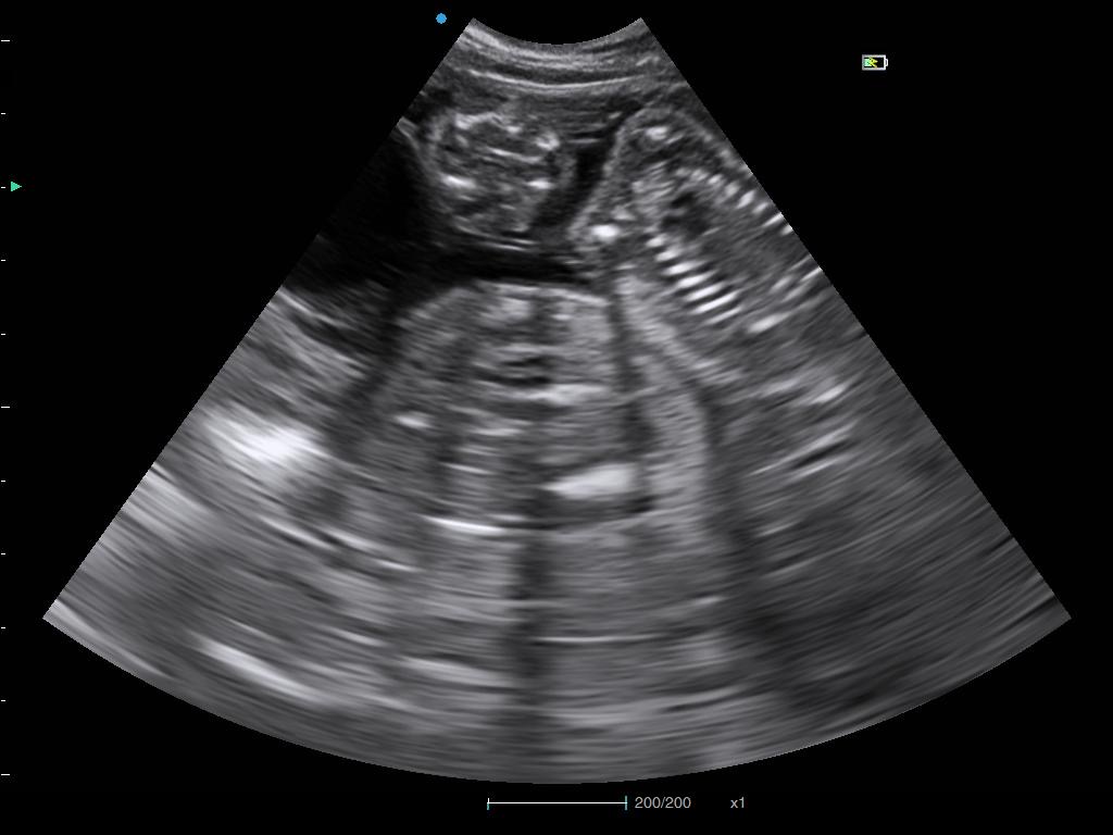 Rescued Cockapoo is PREGNANT! – Animal Ultrasound Association