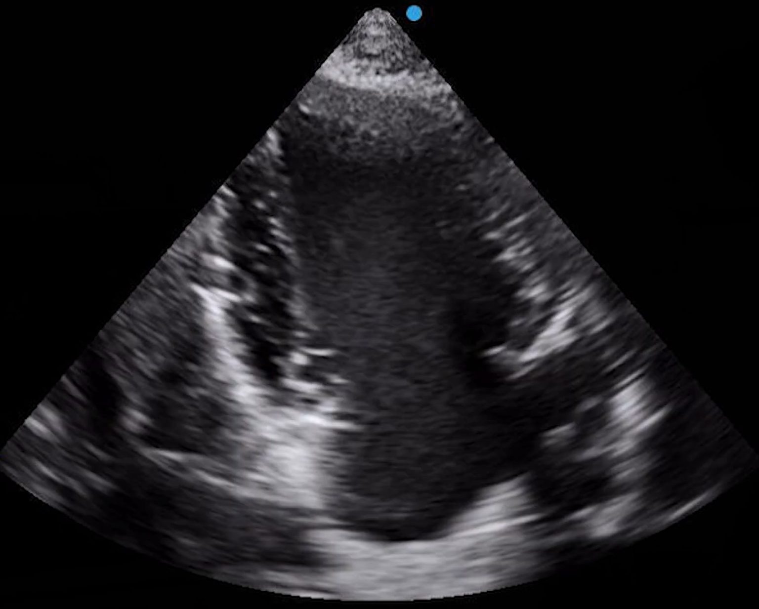 Why do we need multiple apical views in echocardiography? – Animal ...